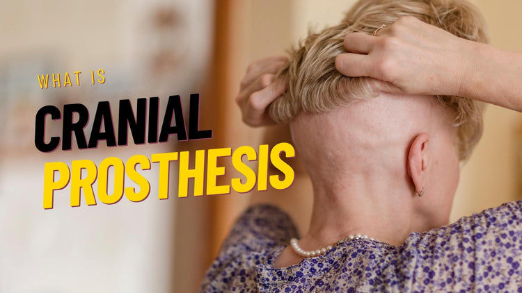 What is Cranial Prosthesis? Learn about Medical Grade Wigs – Wig Medical